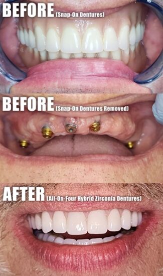 Dentist in Rancho Cucamonga, CA - Smile Gallery Baseline Dental ...